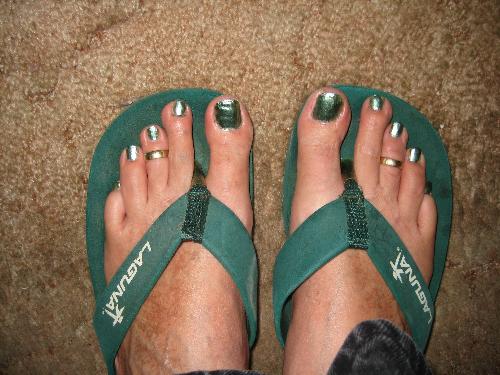 Metallic Green toes - A shot of my feet in forest green sandals with ...