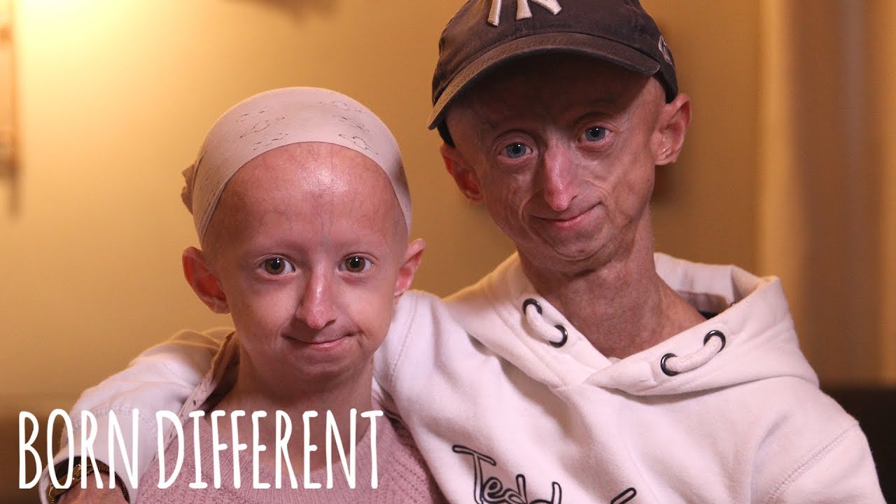 Progeria - the secret to youth? / myLot